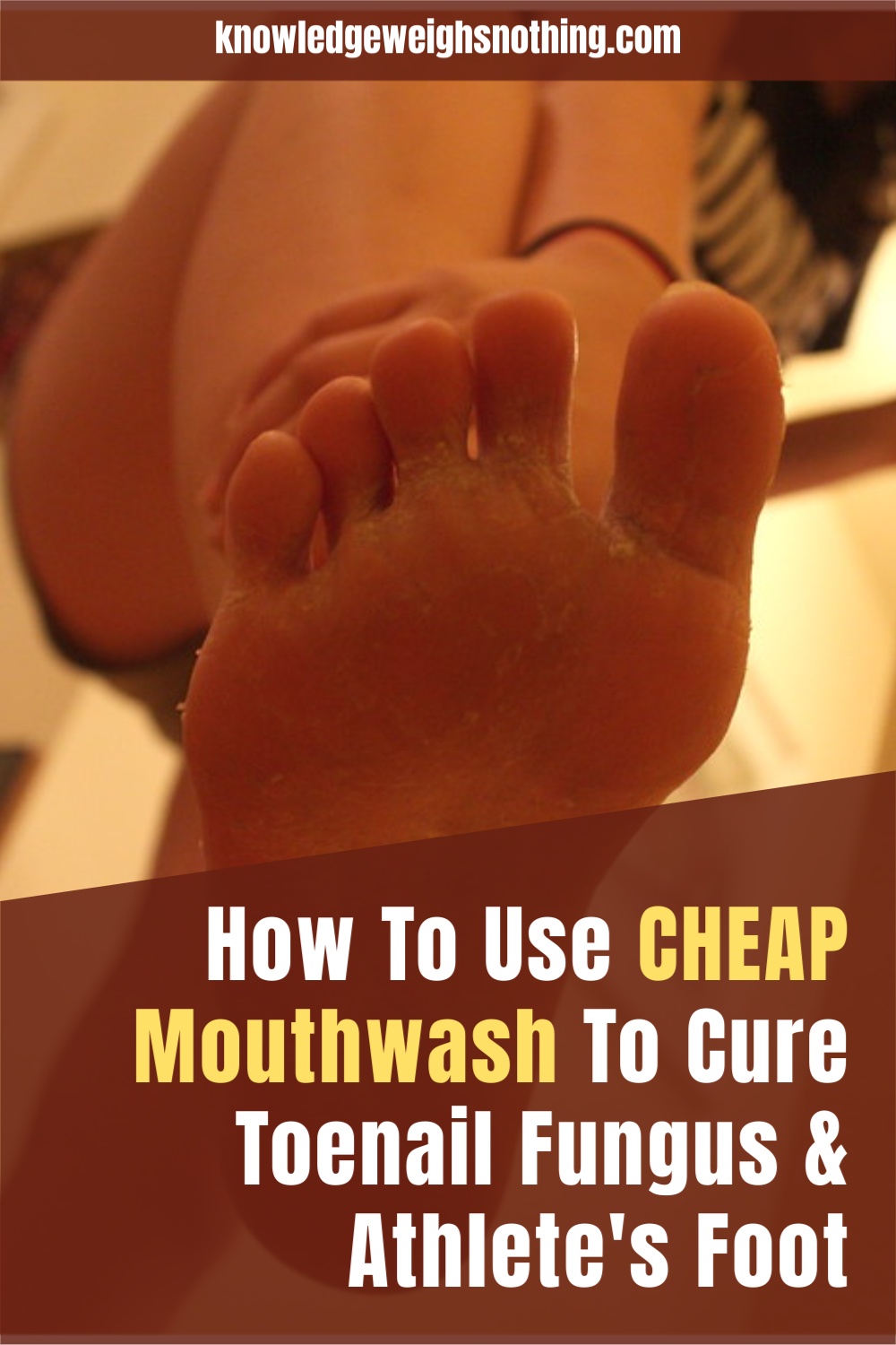 How To Use Cheap Mouthwash To Cure Athlete's Foot