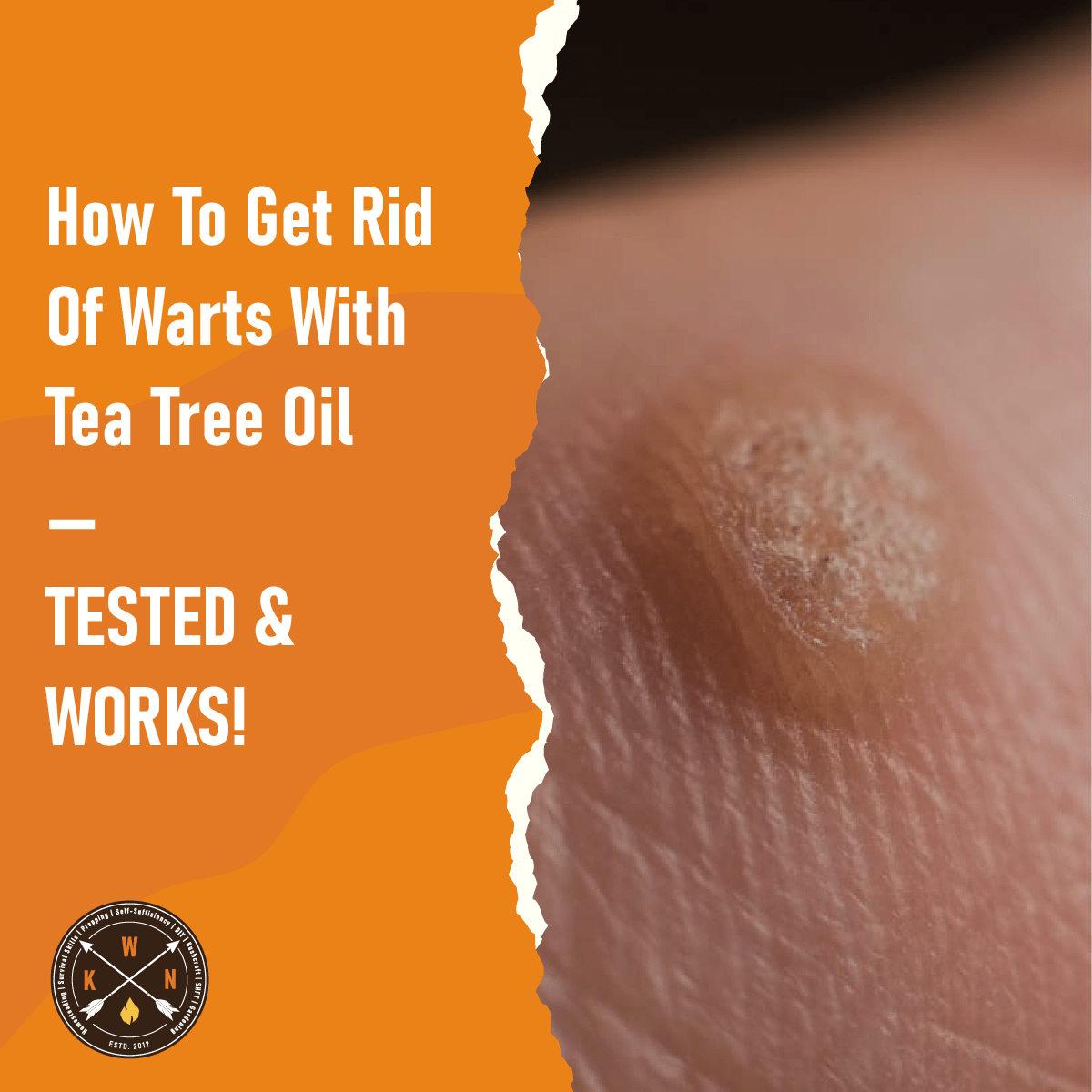 How To Get Rid Of Warts With Tea Tree Oil -- TESTED & WORKS!